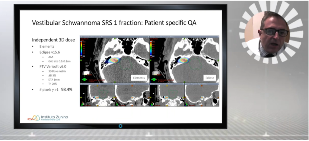 Radiosurgical Approaches to the Treatment of Vestibular Schwannomas