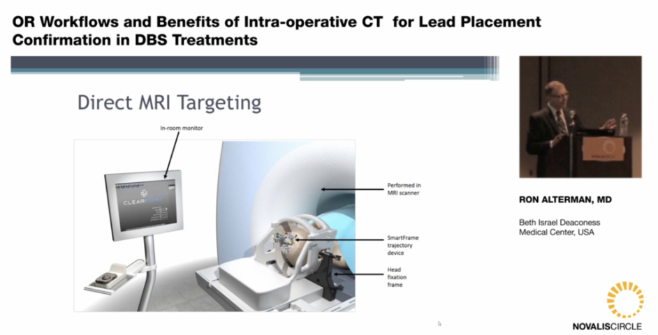 O.R. Workflows and Benefits of Intraoperative CT for Lead Placement ...