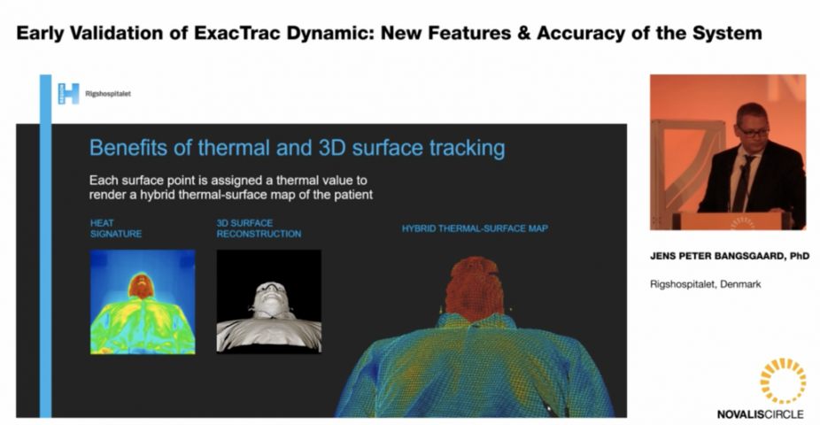 Early Validation of ExacTrac Dynamic: New Features & Accuracy of the System