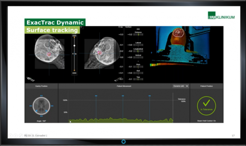 Clinical Versatility of ExacTrac Dynamic
