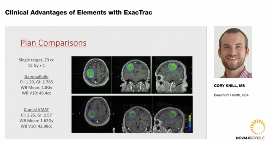 Clinical Advantages of Elements with ExacTrac