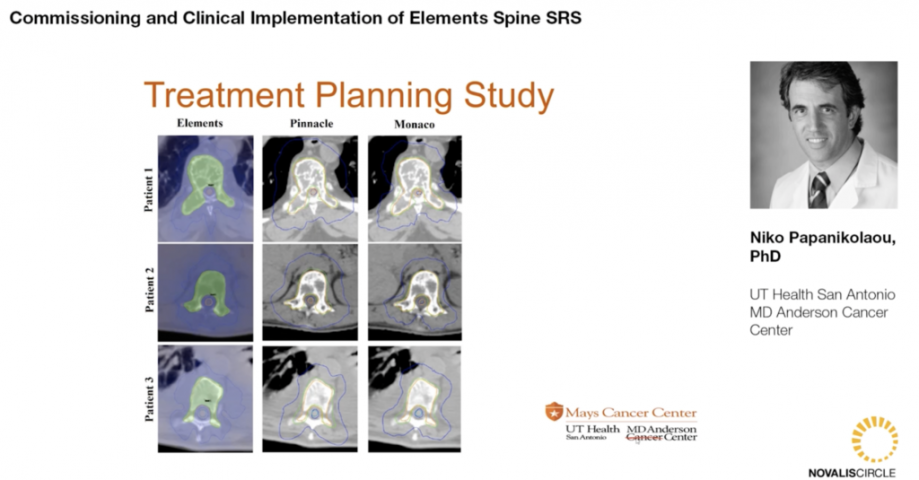 Commissioning and Clinical Implementation of Elements Spine SRS