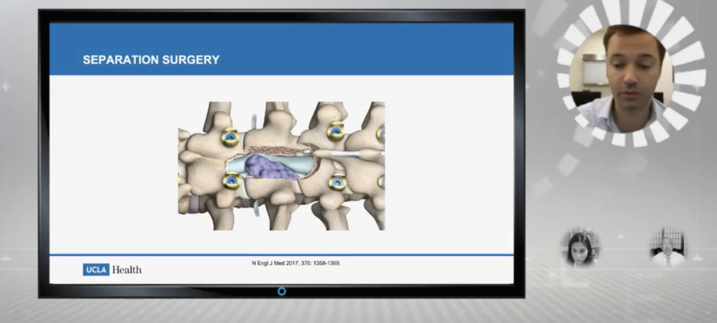 Case of the Month Webinar: Separation Surgery + Radiosurgery for Spine ...